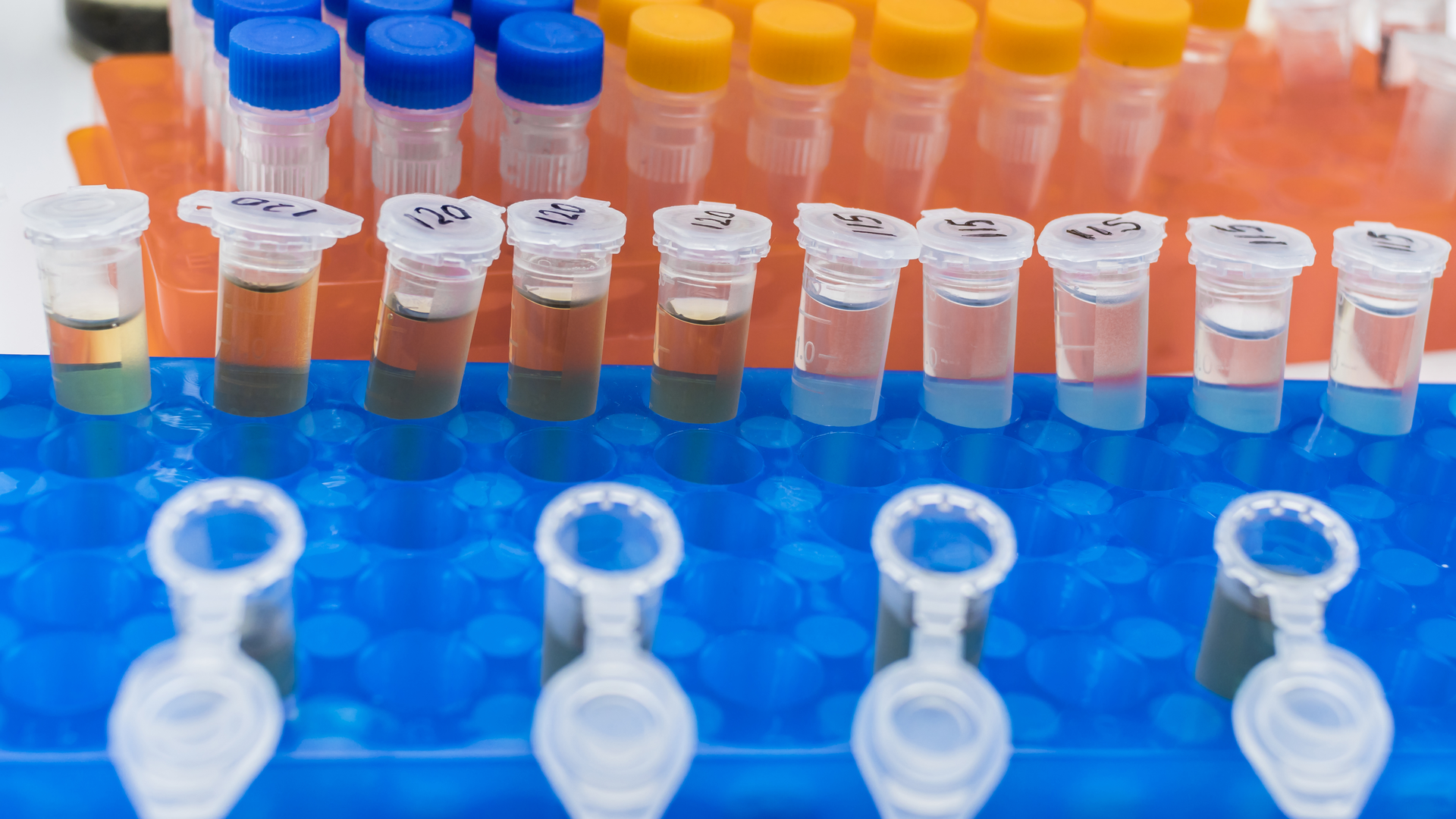 Machine learning estimates number of people in wastewater sample ...